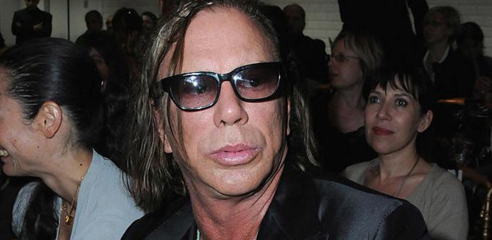 Chirurgia Plastica Mickey Rourke Prima E Dopo