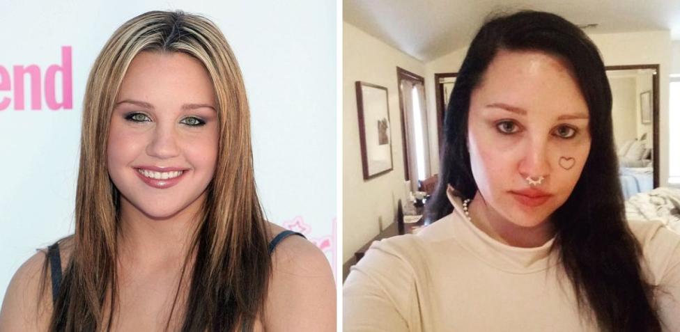 Amanda Bynes Rinoplastica Prima E Dopo