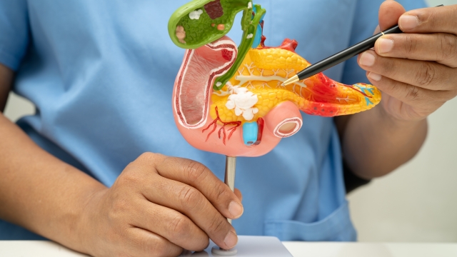 Tumore al pancreas: una 70enne salva grazie al vaccino a mRna | Gazzetta.it
