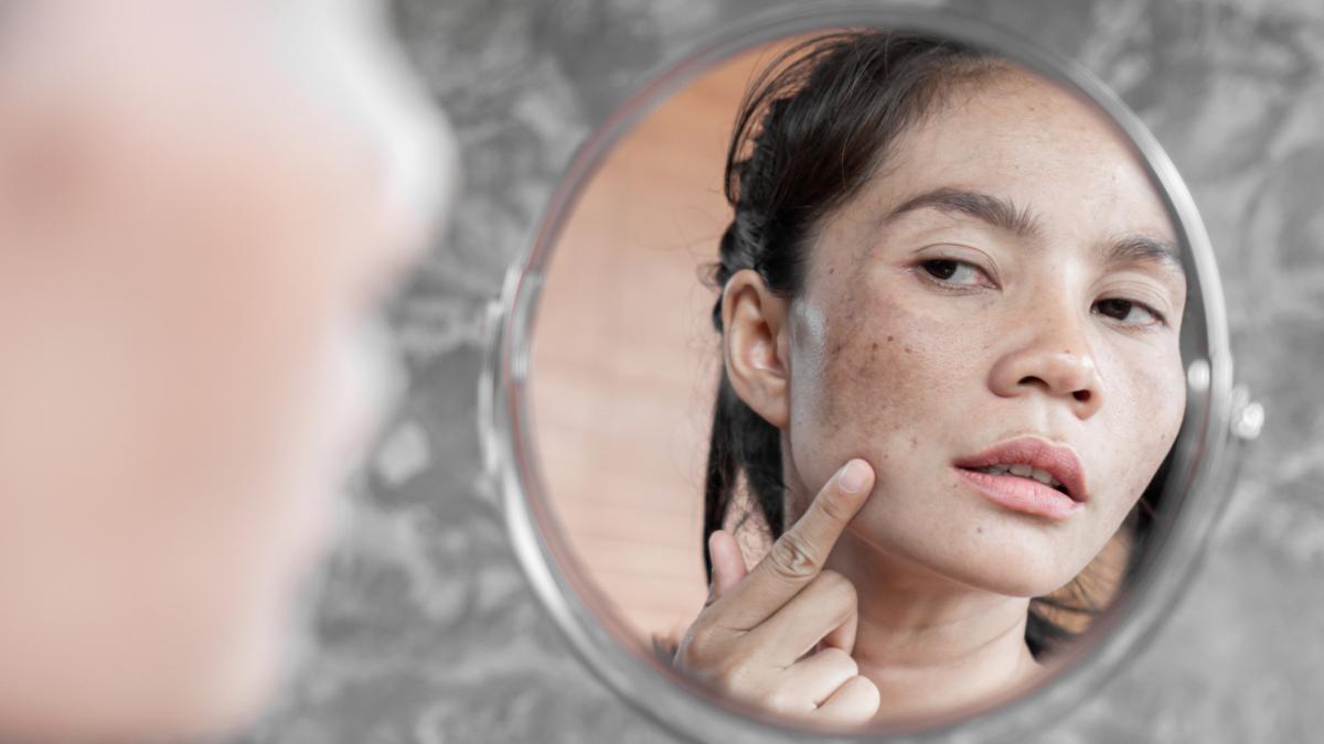 Skin shaming: come difendersi dalle offese per inestetismi della pelle ...