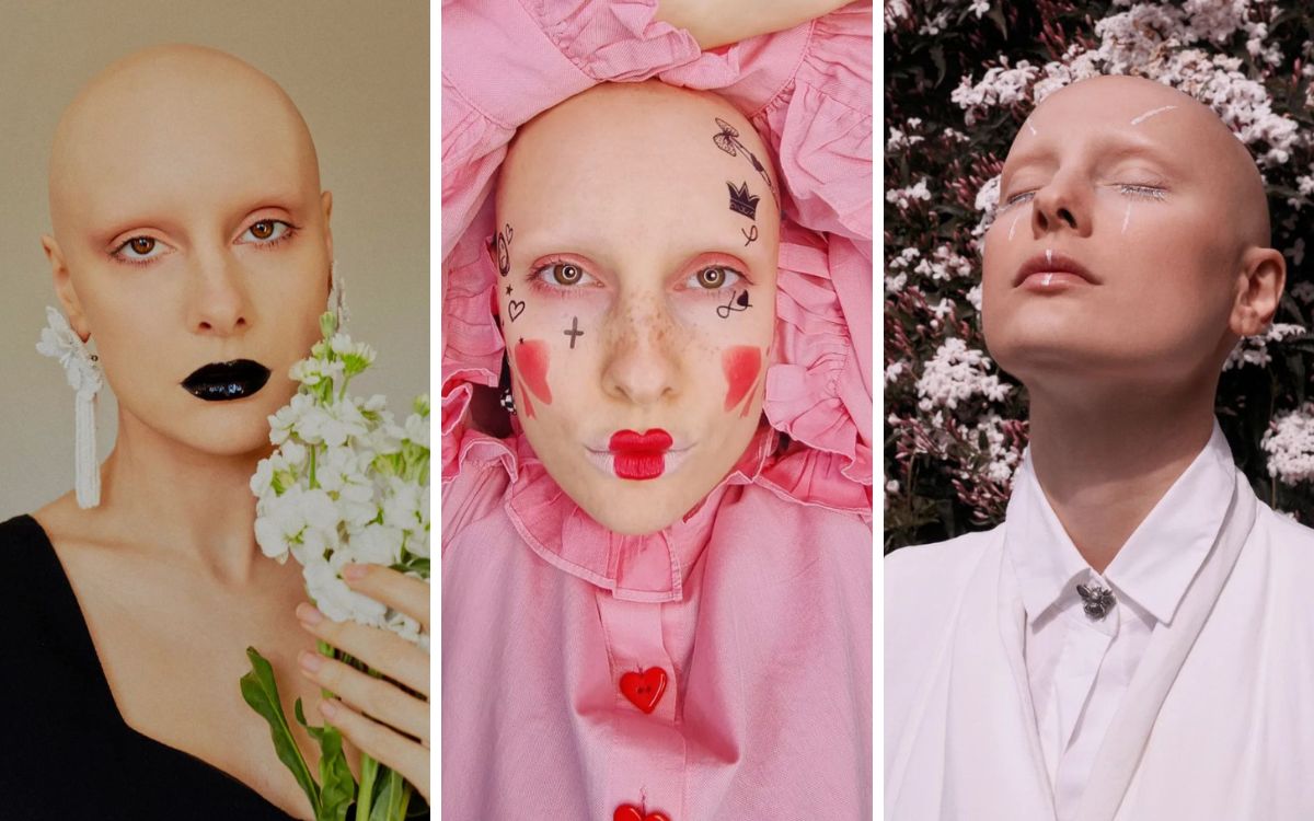 Chi è Miss Swirl, la modella e influencer con tricotillomania | Gazzetta.it