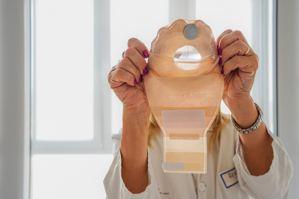 Ileostomia: cos'è, quando si fa e per quali malattie | Gazzetta.it
