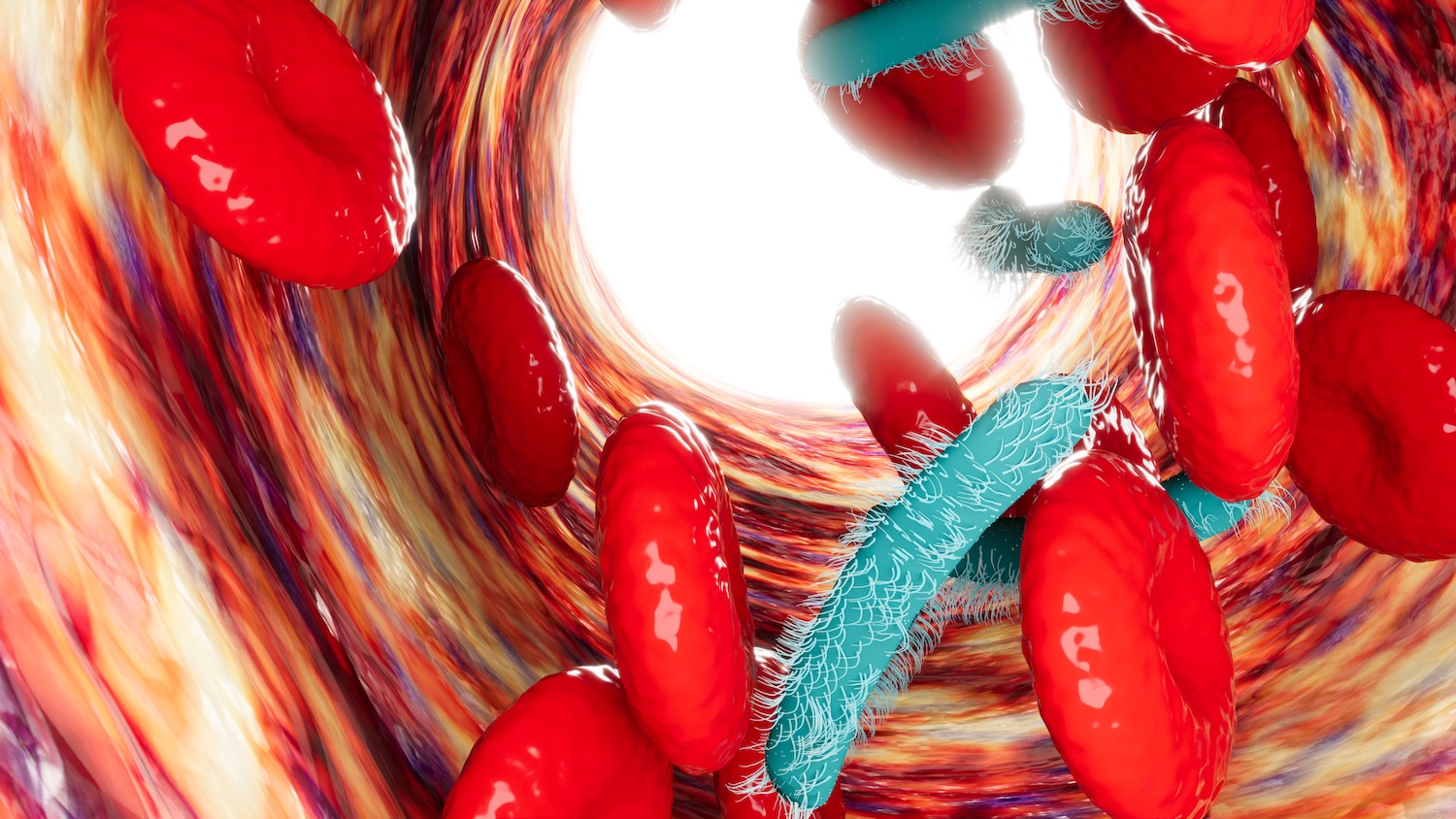 Sepsi: significato, cos'è, complicanze, rischi per Papa Francesco ...