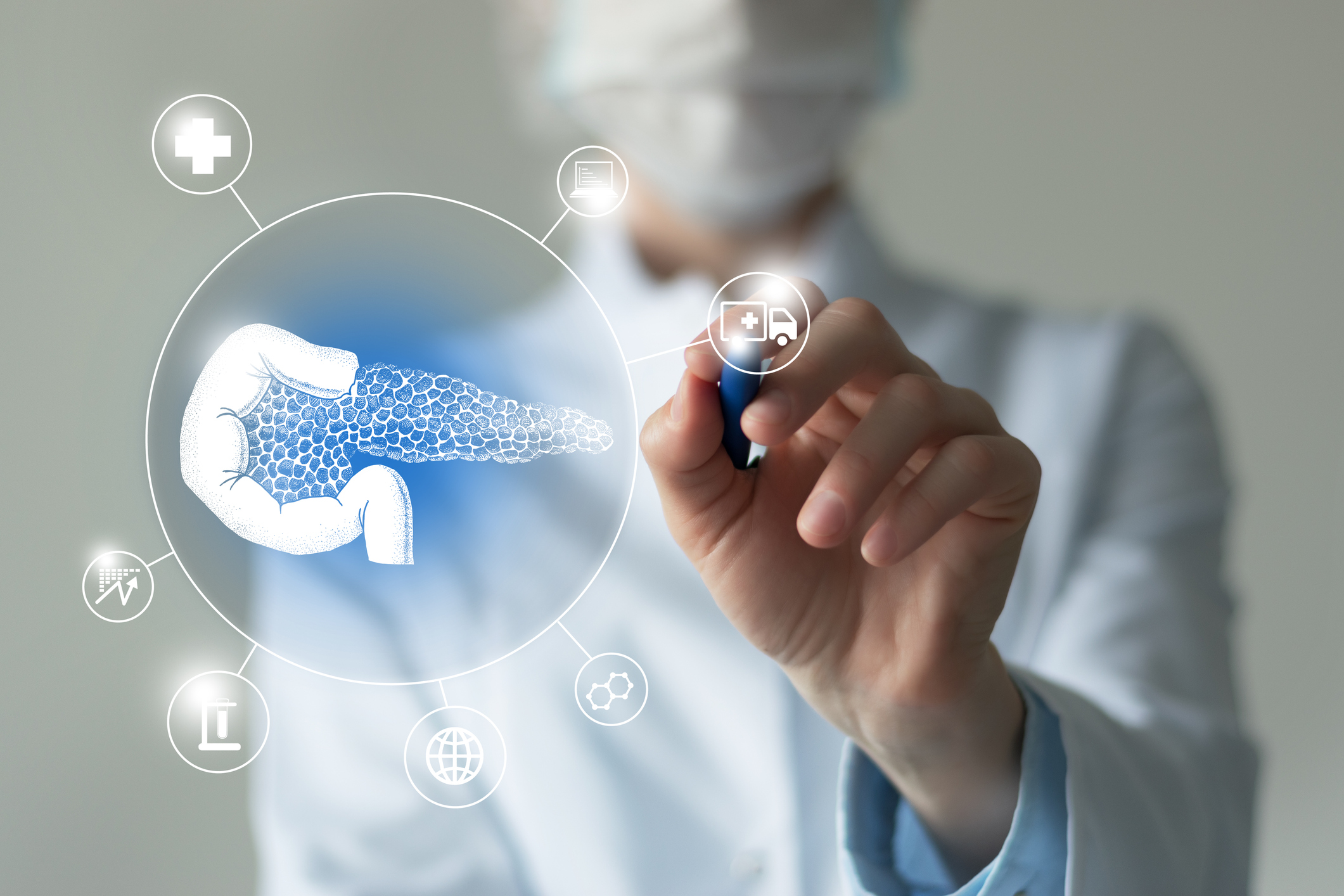 Tumore al pancreas: nuovo farmaco raddoppia la sopravvivenza al cancro ...